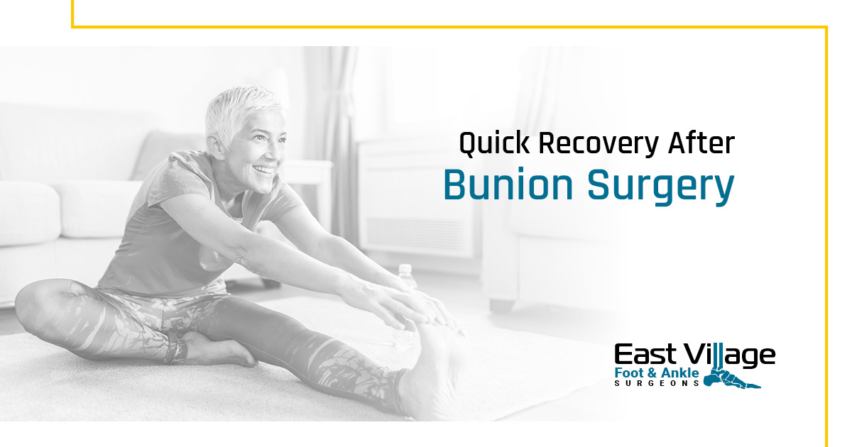 Bunion Surgery Recovery Tips | East Village Foot & Ankle Surgeons